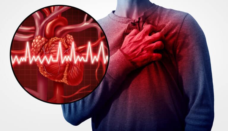 Cirugía a corazón abierto:cuánto dura, cómo se hace y riesgo