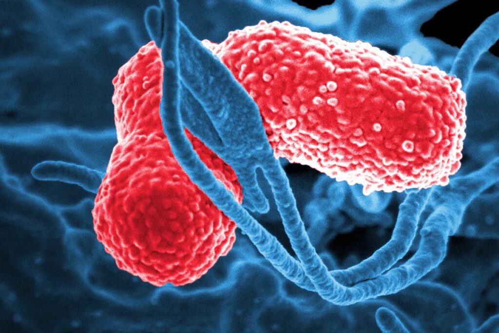 ¿Qué es la Klebsiella oxytoca y cuáles son sus síntomas? Piden no ...